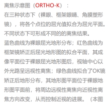精准离焦检测 思问眼科