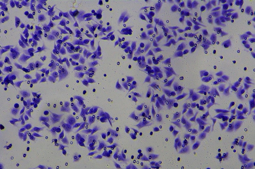 transwell侵袭、迁移实验-湖南慧登生物科技有限公司