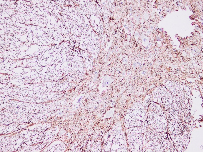 免疫组化IHC-湖南慧登生物科技有限公司