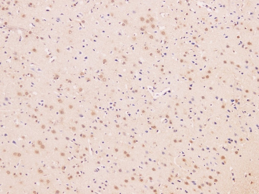 免疫组化IHC-湖南慧登生物科技有限公司