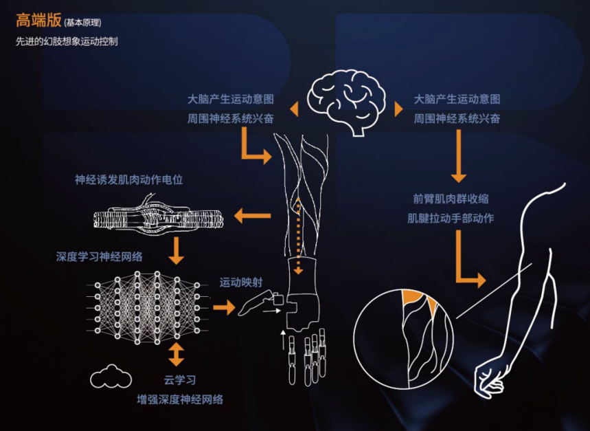 BrainRobotics 智能仿生手-浙江星源假肢矫形器有限公司